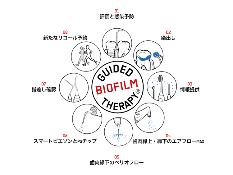 GBTメンテナンス - 医療法人 末永歯科医院 - 福島市の歯医者